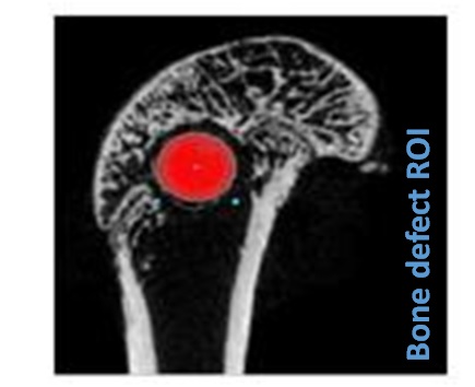 Biomaterials | Atlantic Bone Screen